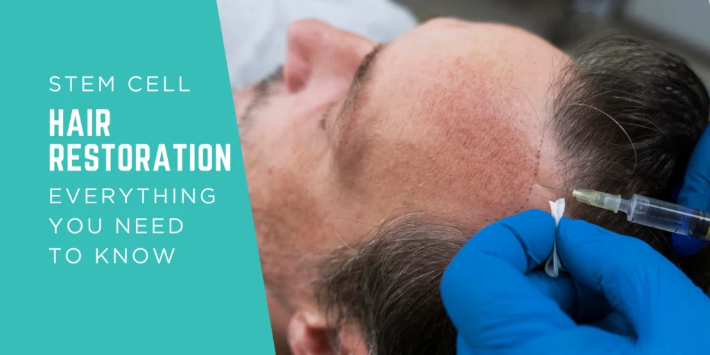 Stem Cell Hair Restoration: What to Know Before Surgery